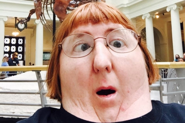 „Někdo tak ošklivý by měl mít zákaz se fotit.” Žena se vzácným ...